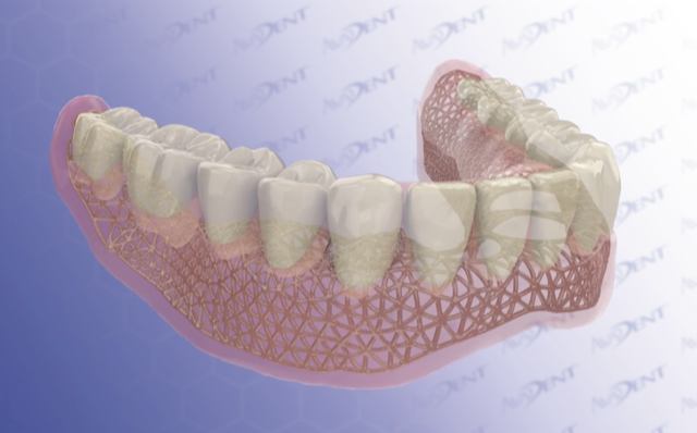Updates in Prosthodontics